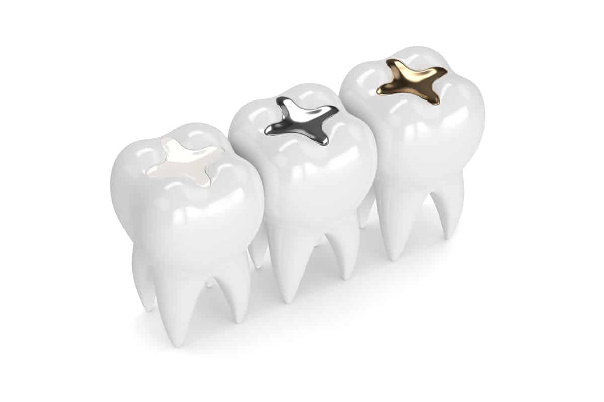 Mercury Free Dentistry Georgetown, Ontario | Halton Village Dental